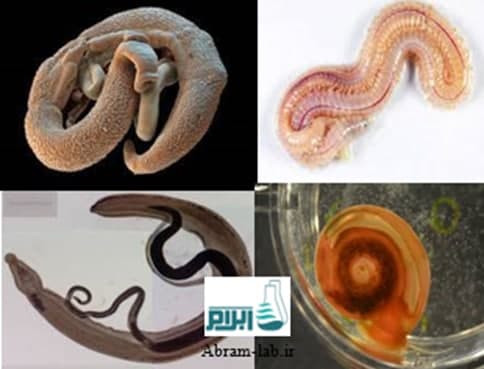 مسیرهای انتقال پاتوژن ها و انگل های مرتبط با آب| آزمایش آب | آزمایشگاه آب